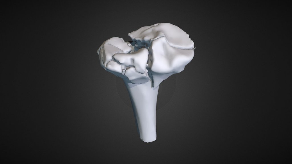 DKOU17 | #10 Proximal Tibia (L-170879-L) - 3D model by World Surgery ...