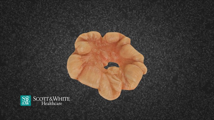 Jejunum 3D models - Sketchfab