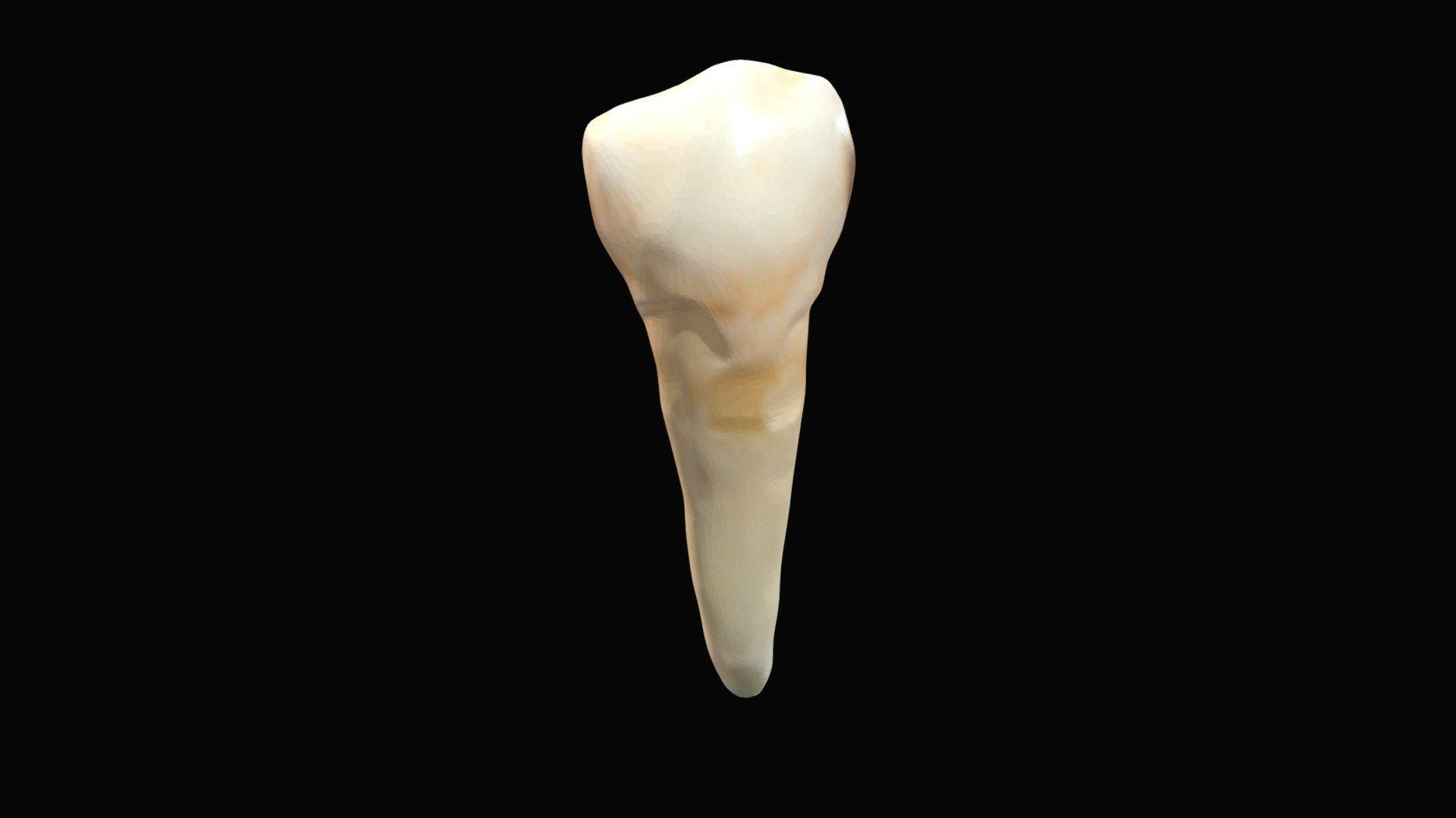 Segundo premolar mandibular derecho (4.5) - 3D model by GIDPTD [3ddb72d ...