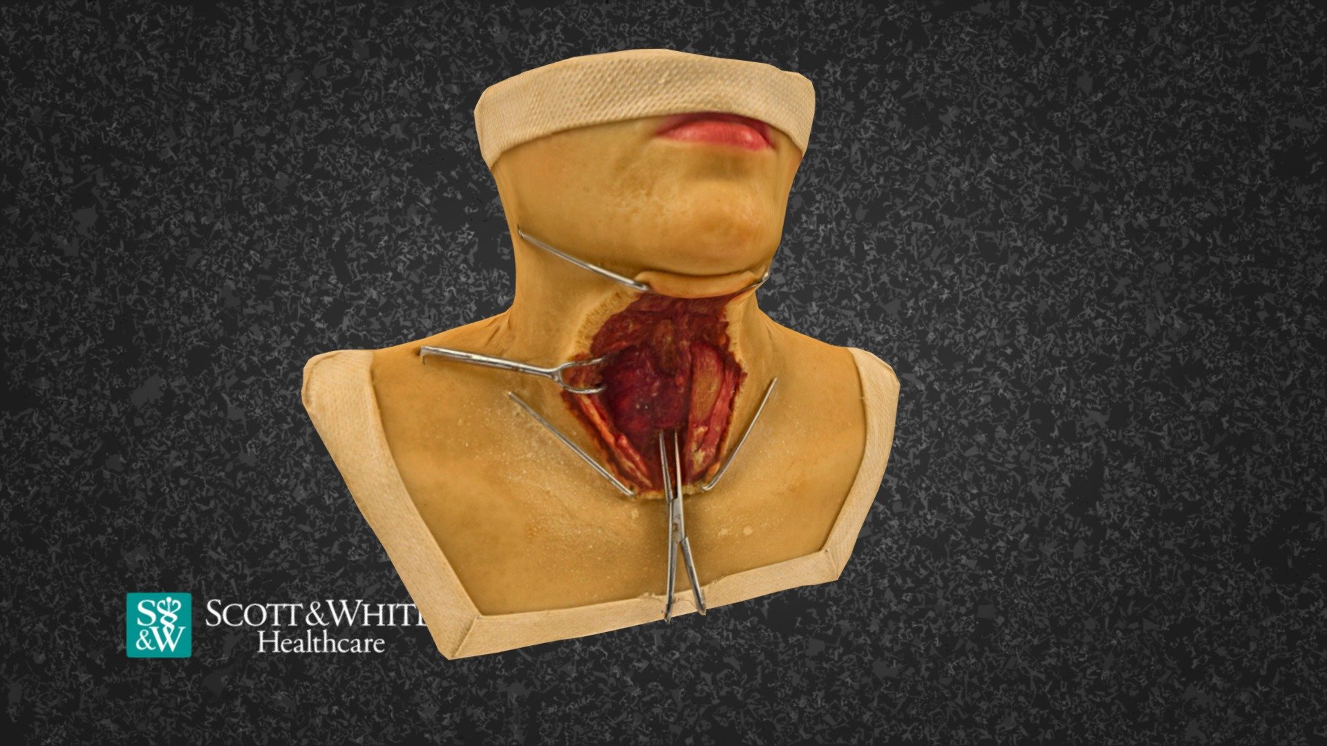 Total Thyroidectomy Surgery - 03 - 3D model by Scott & White Moulage ...