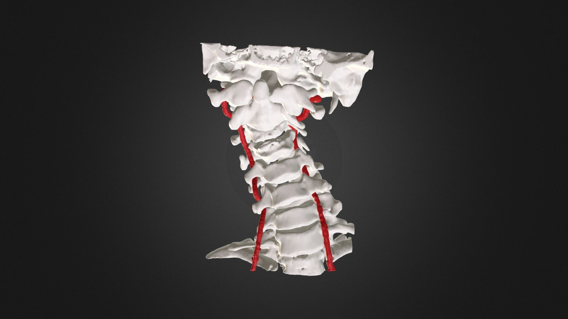 C-Spine with Vertebral Arteries - 3D model by yuhuihuang [3efdb66 ...