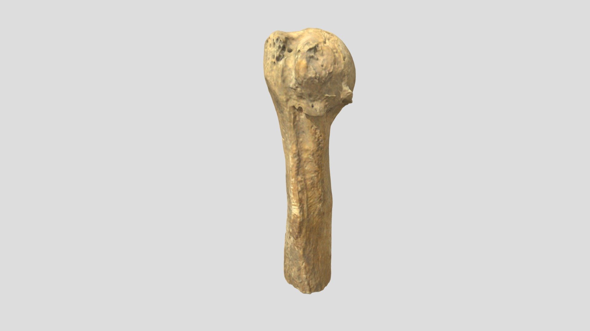 CA-671 Right Humerus Fracture - 3D model by r.j.gilmour [3f5df1b ...