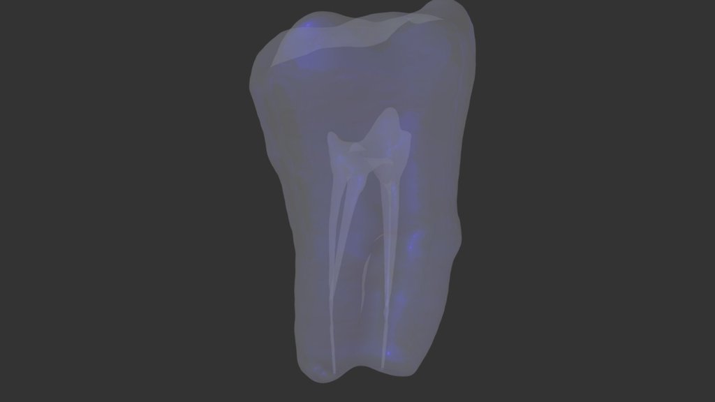 Tooth Root Canal Type II - 3D model by GeorgeMicroDental [3f9432e ...