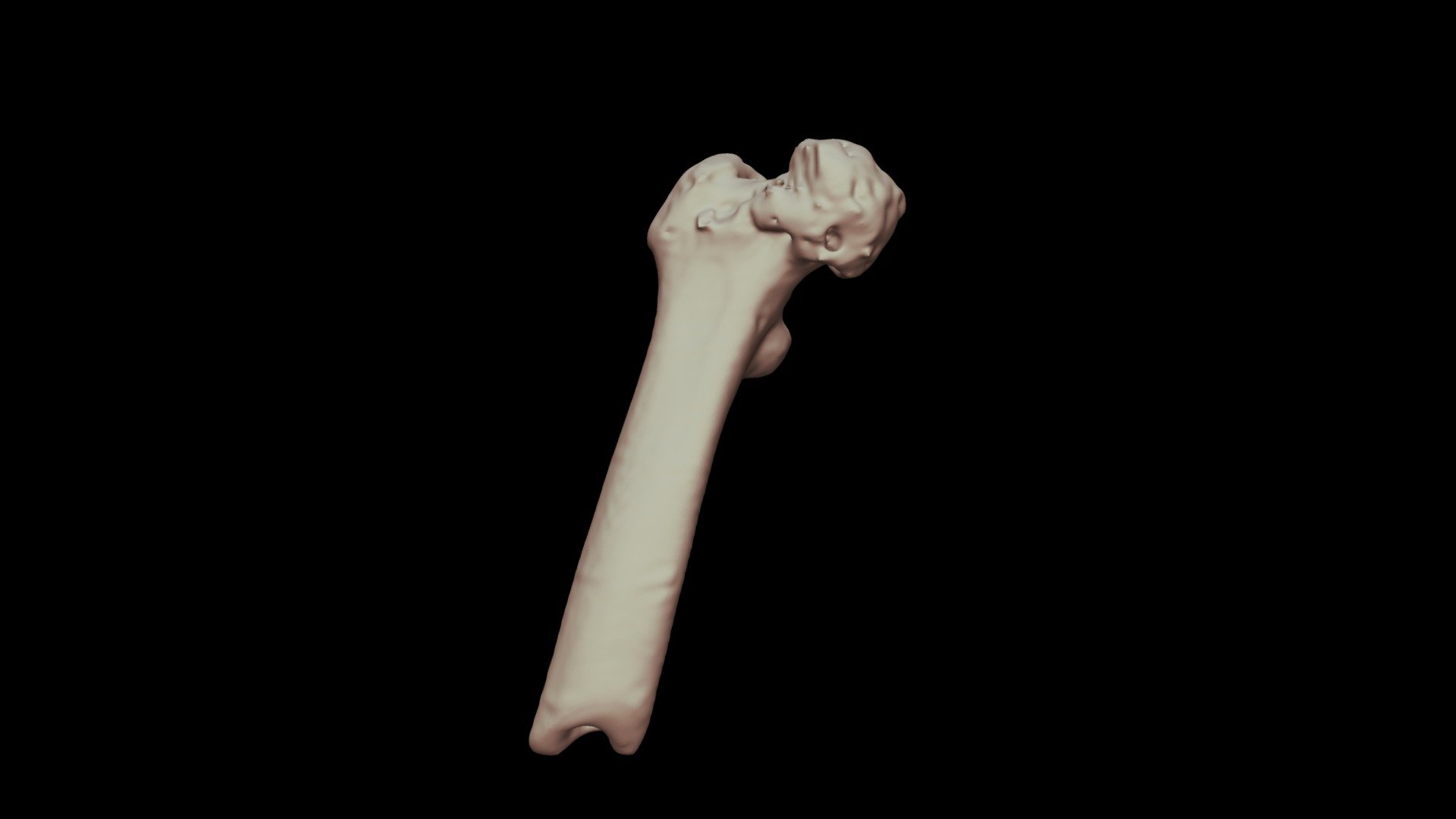 Segmentation_f rt - 3D model by Medimax Advance Radio-Imaging ...