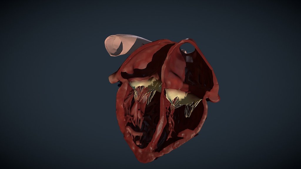 Subcostal 4 Chamber Echo Plane - 3D model by kawstovhbx [3fa1fa4 ...