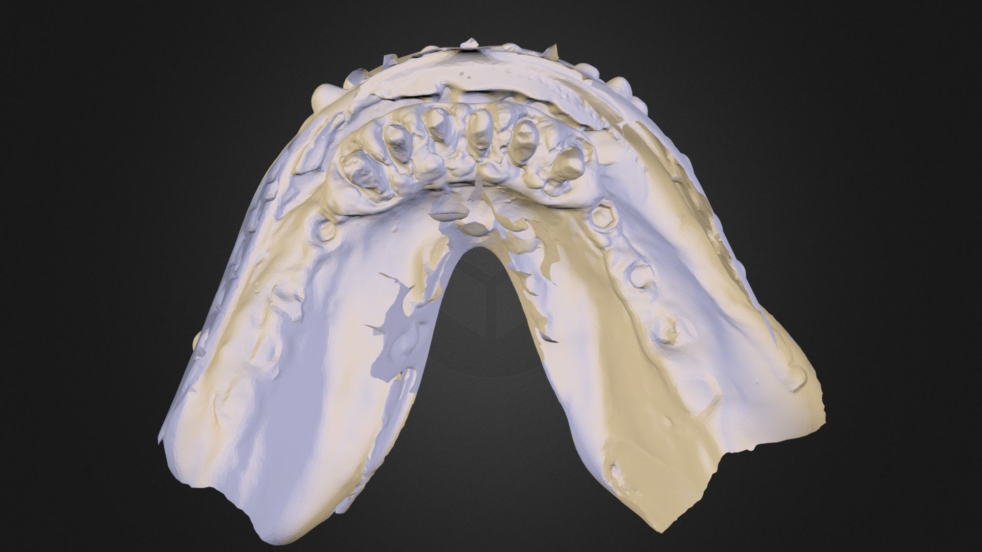 Raw Preparation scan.stl - 3D model by SergeiUmanskii [3xlLRH4] - Sketchfab