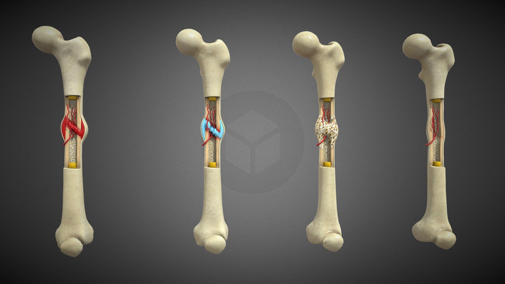 Human Bone Recovery Stages - Buy Royalty Free 3D model by Devden ...