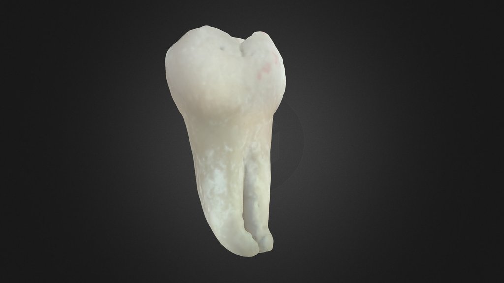Segundo Molar Superior - Upper Second Molar - A 3D model collection by ...