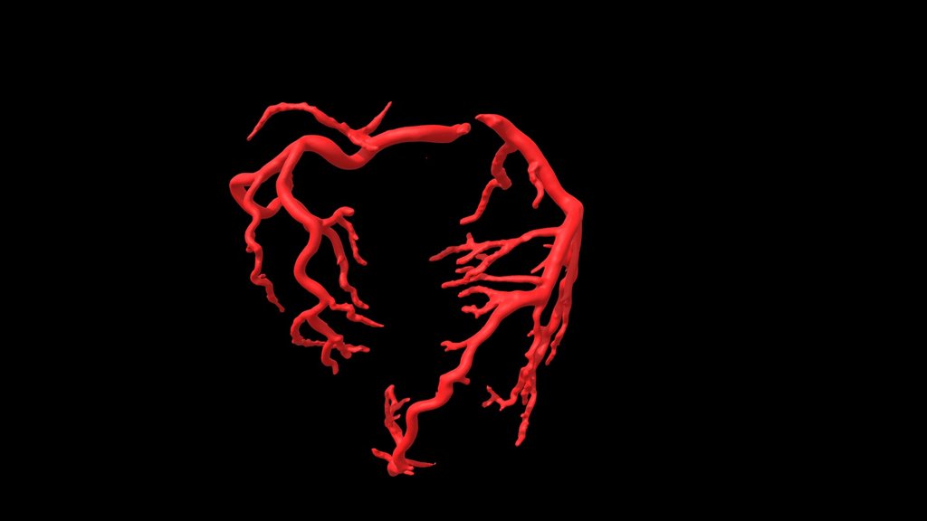 Coronary Arteries - A 3D model collection by VisibleHeartLabs - Sketchfab