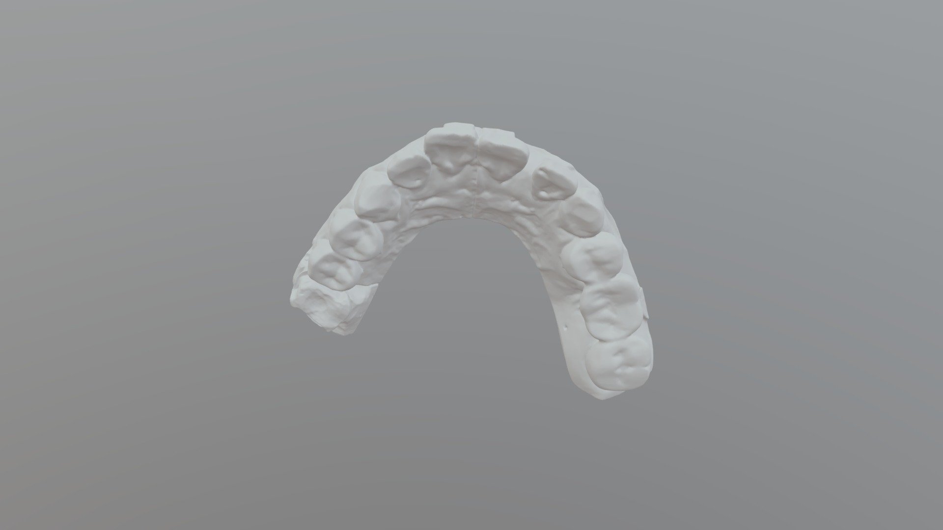 Preparation Scan - 3D model by Rael..Tsai [40d1aca] - Sketchfab