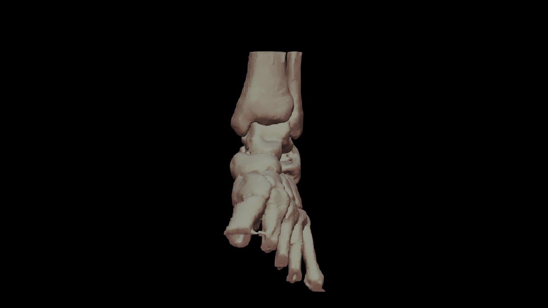 PALAK TRIVEDI - 3D model by Medimax Advance Radio-Imaging ...
