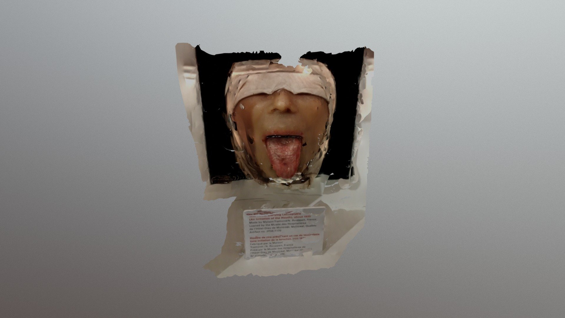 Medical Teaching Model (Syphilis) - Download Free 3D model by ...