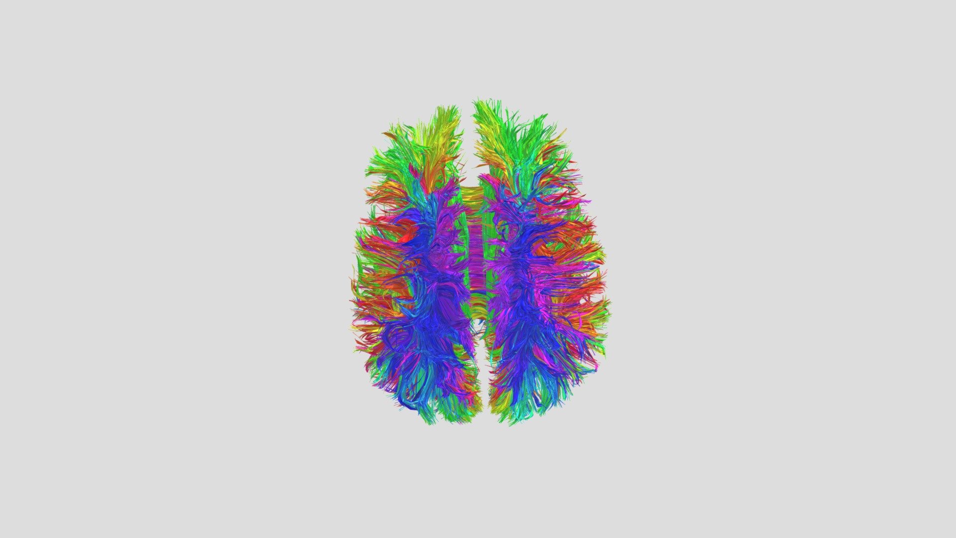 Tractography- Fiber-whole-clean-final - 3D model by JT5D [41282a0 ...