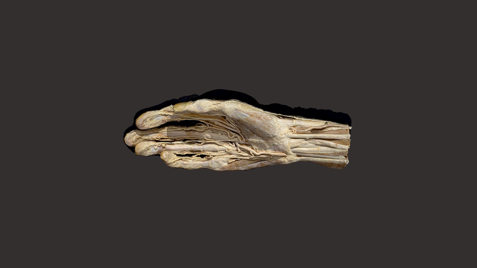 Palmar Hand with Muscles Labelled - 3D model by ...