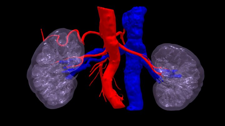 Dicom 3D models - Sketchfab