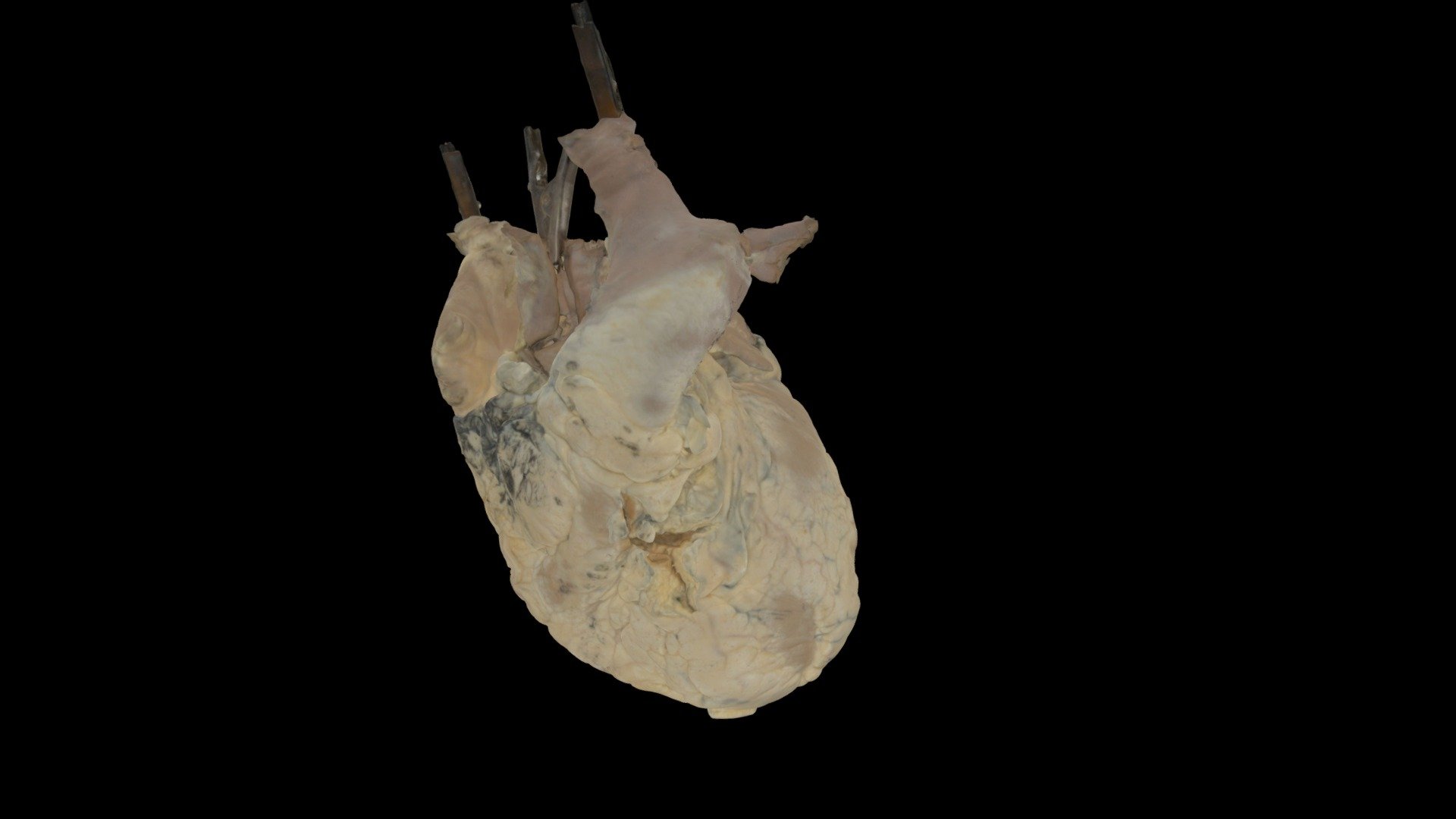 Fixed Human Heart 0035 - Download Free 3D model by VisibleHeartLabs ...