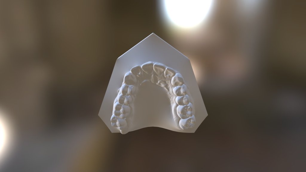 Maxillary Model - 3D model by drandrescordova [41862ab] - Sketchfab