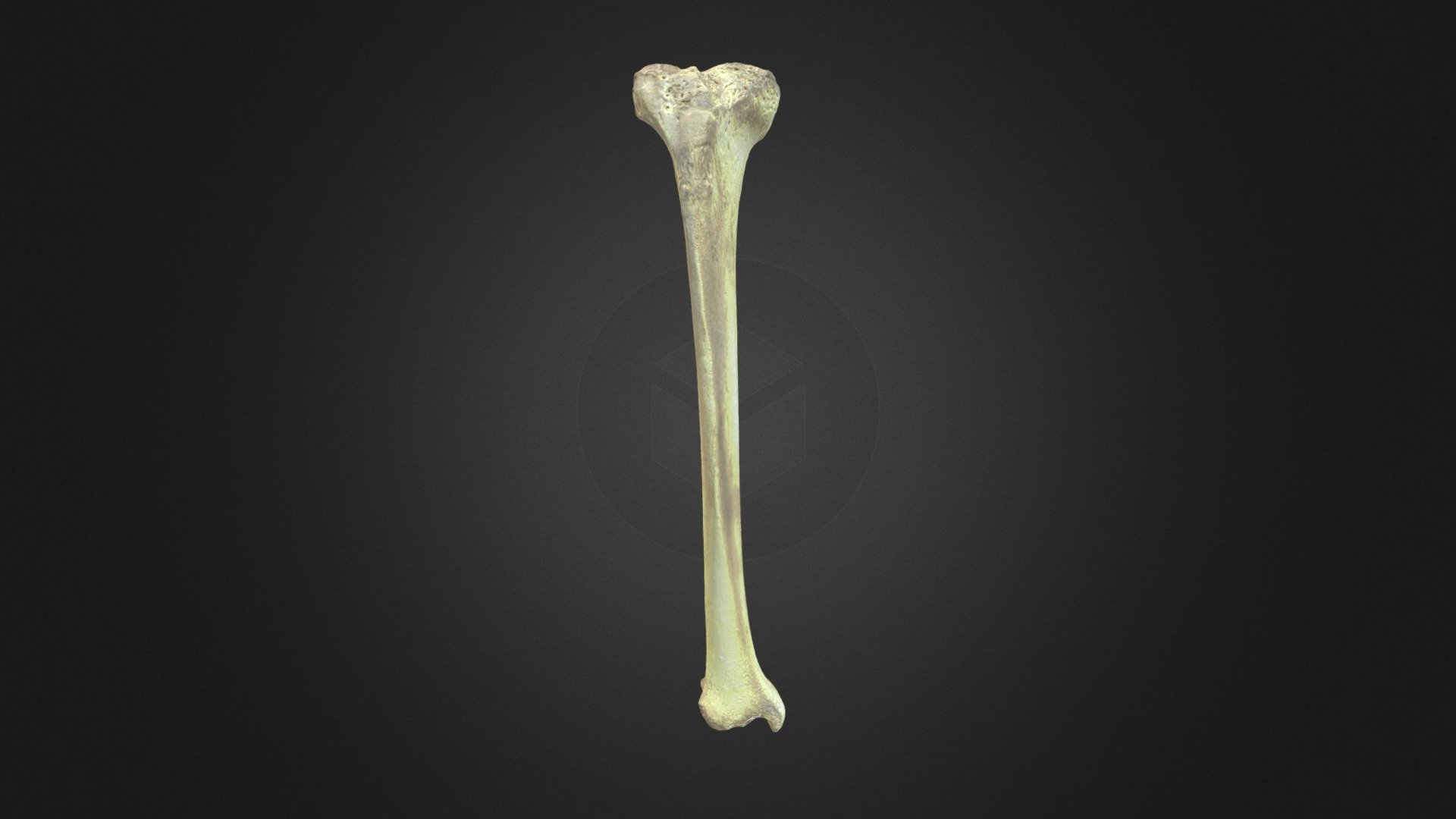 Human Tibia - 3D model by UBC Medicine - Educational Media [41a8db0 ...