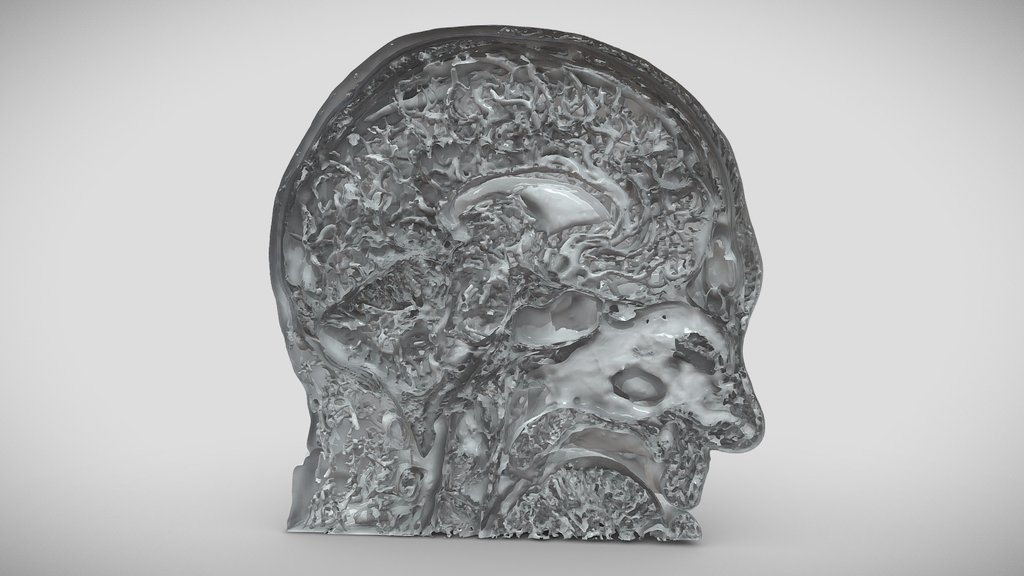 3D Human Anatomy - A 3D model collection by Advanced Visualization Lab ...