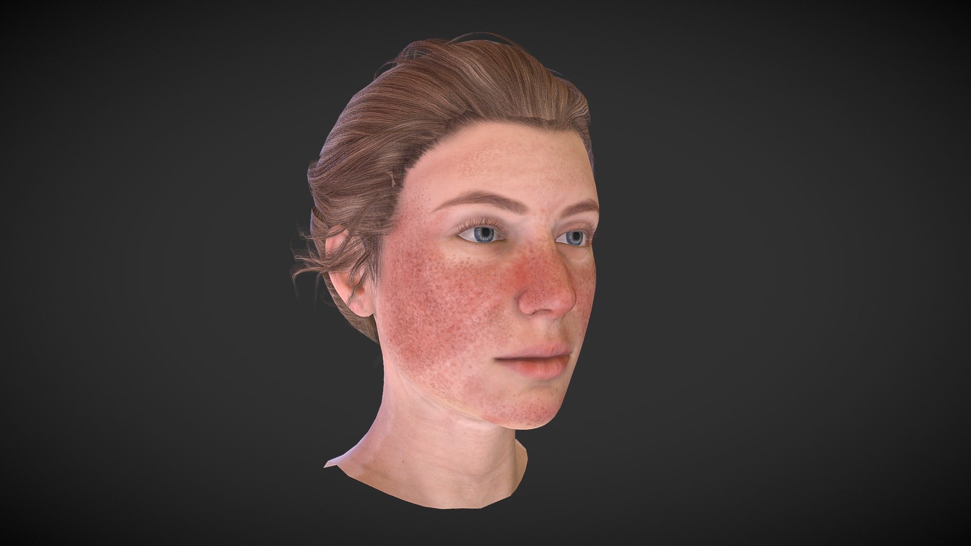 Systemic lupus - Buy Royalty Free 3D model by Ebers [429d019 ...