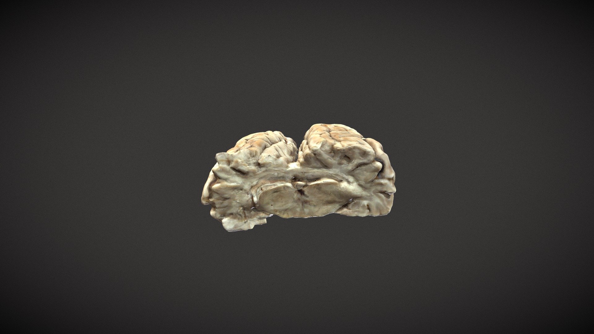 Corte coronal del encéfalo - 3D model by AnatomiaIIIA [42f9aec] - Sketchfab
