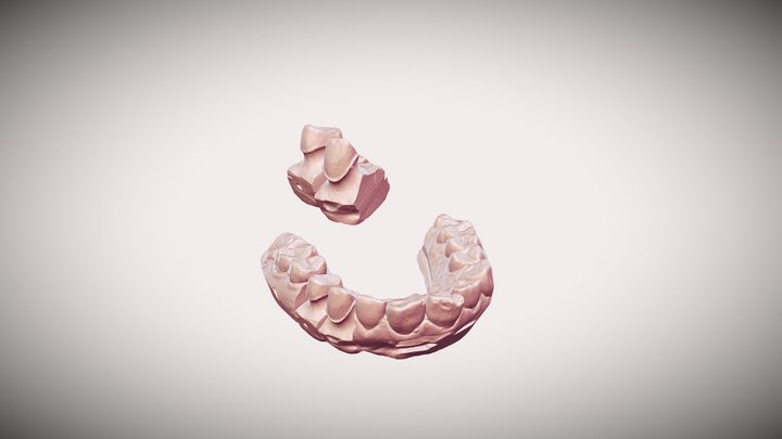 Dentures 3D models - Sketchfab