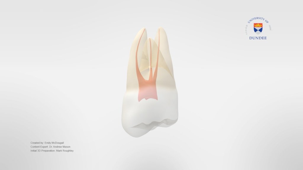 Permanant Teeth: Pulp Chamber Morphology - A 3D model collection by ...