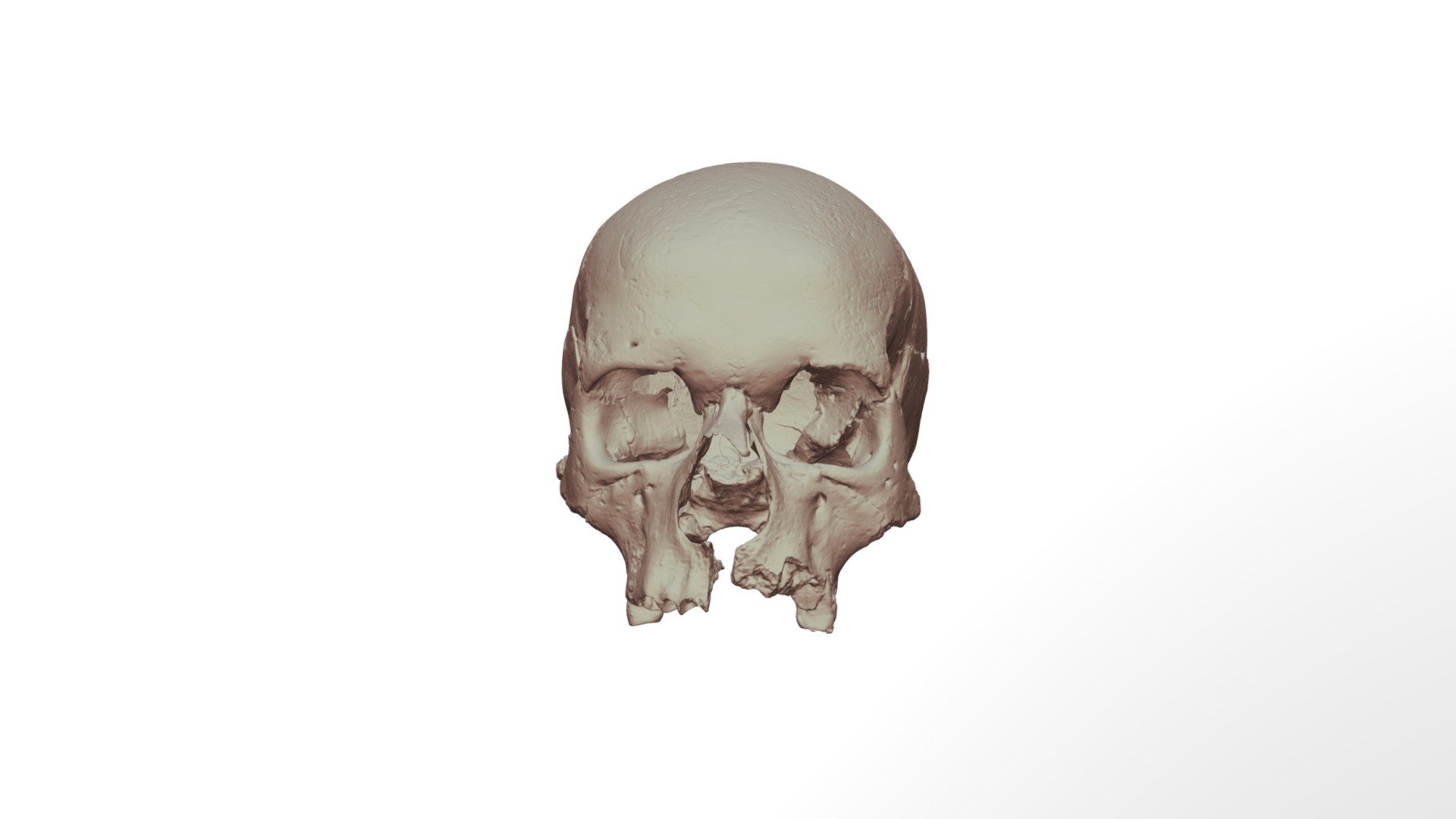 Walkington Wold Skull - 3D model by krupasayania [44fe5aa] - Sketchfab