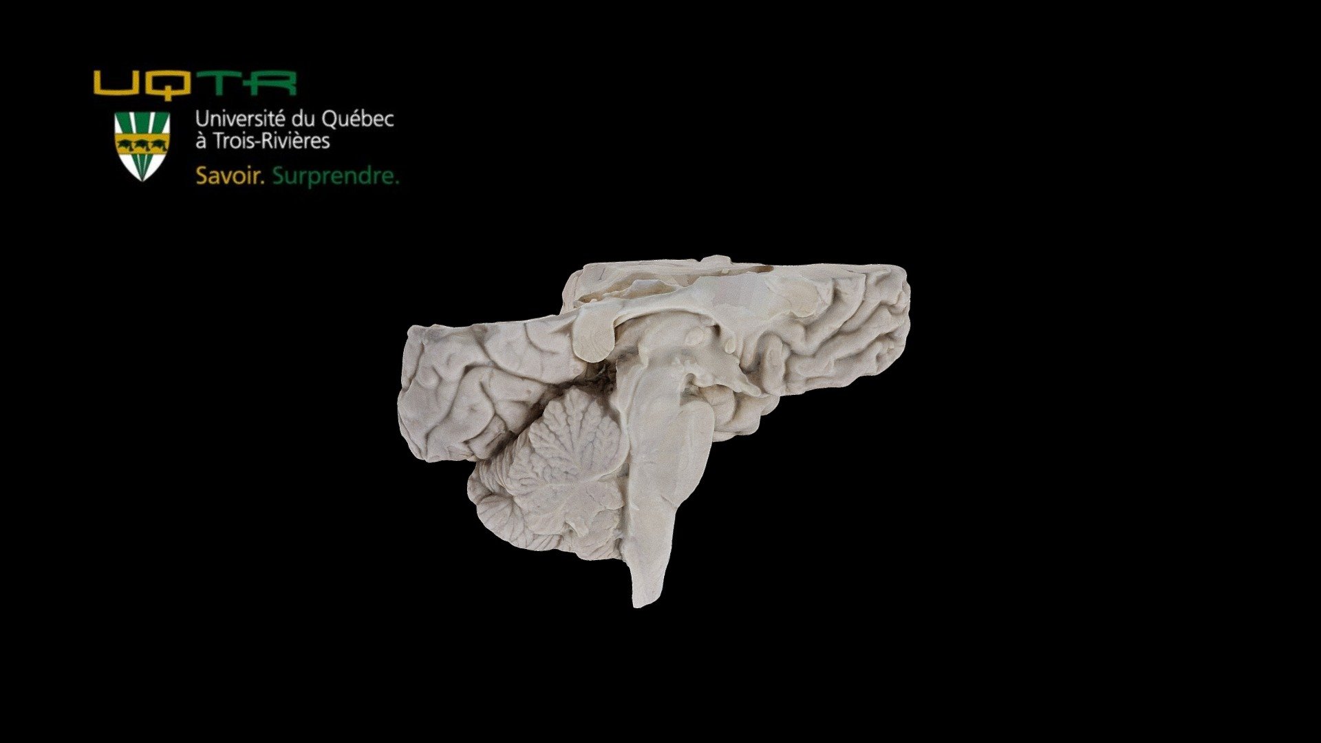 Cerveau 03 / Brain 03 (plastinated) - 3D model by Anatomie UQTR ...