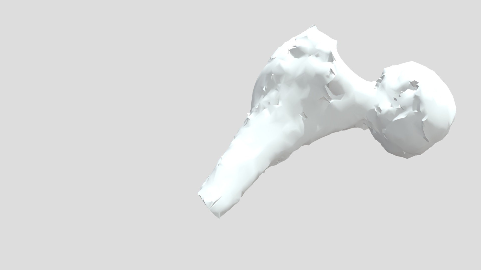 MRI of CAM-Type FAI - Download Free 3D model by jefferyjohn [45e33f4 ...