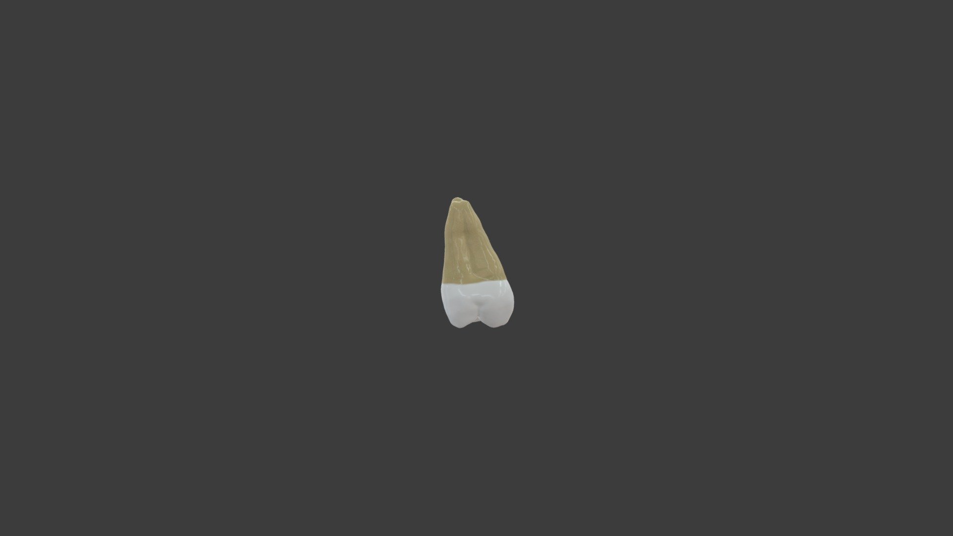 Maxillary 3rd Molar Right - 3D model by Ahmed Mahrous (@drahedmahrous ...