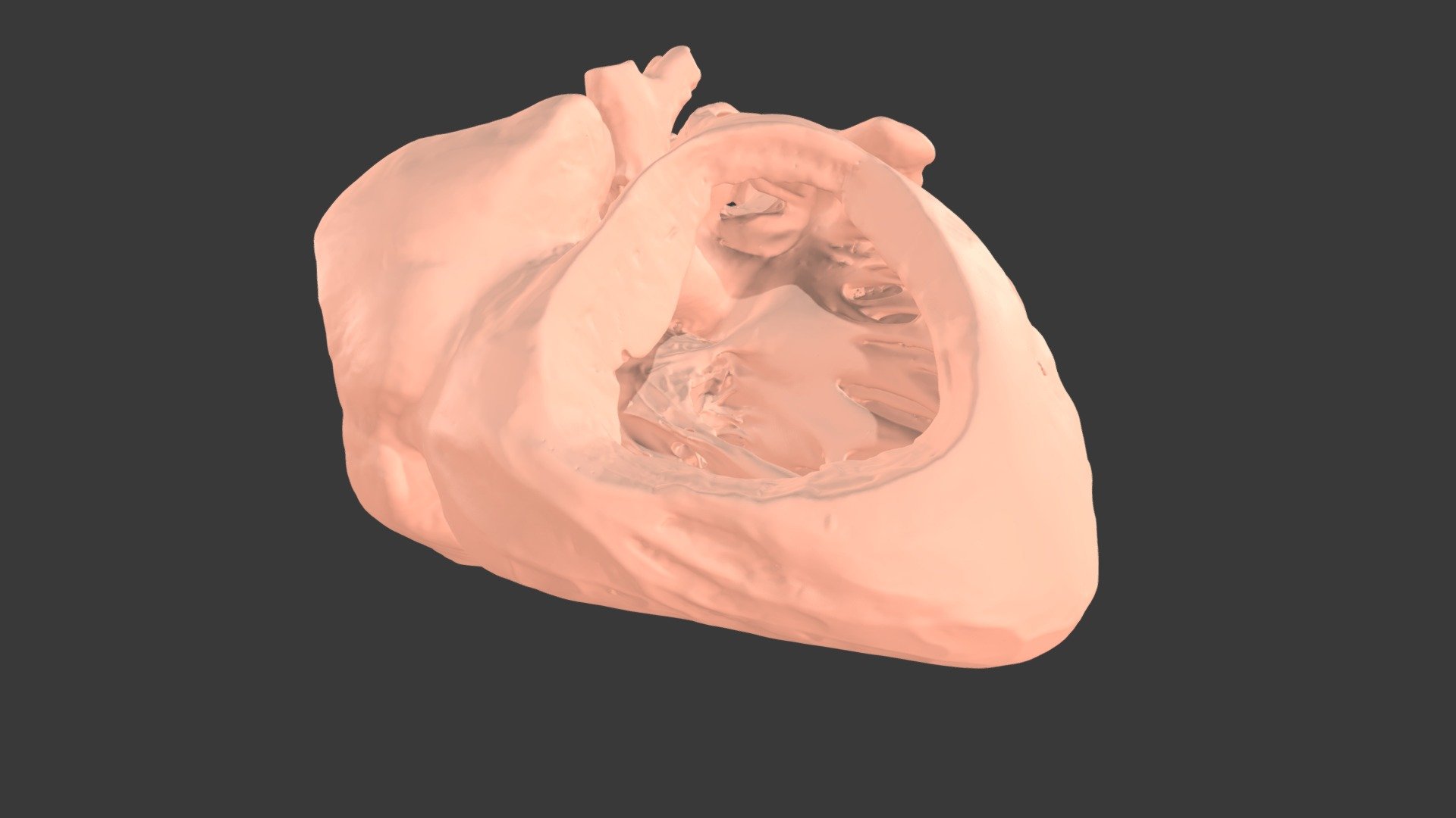 HLHS #1 - HLHS {S,D,S} (AS/MS) - 3D model by heartmodels [4771f9f ...