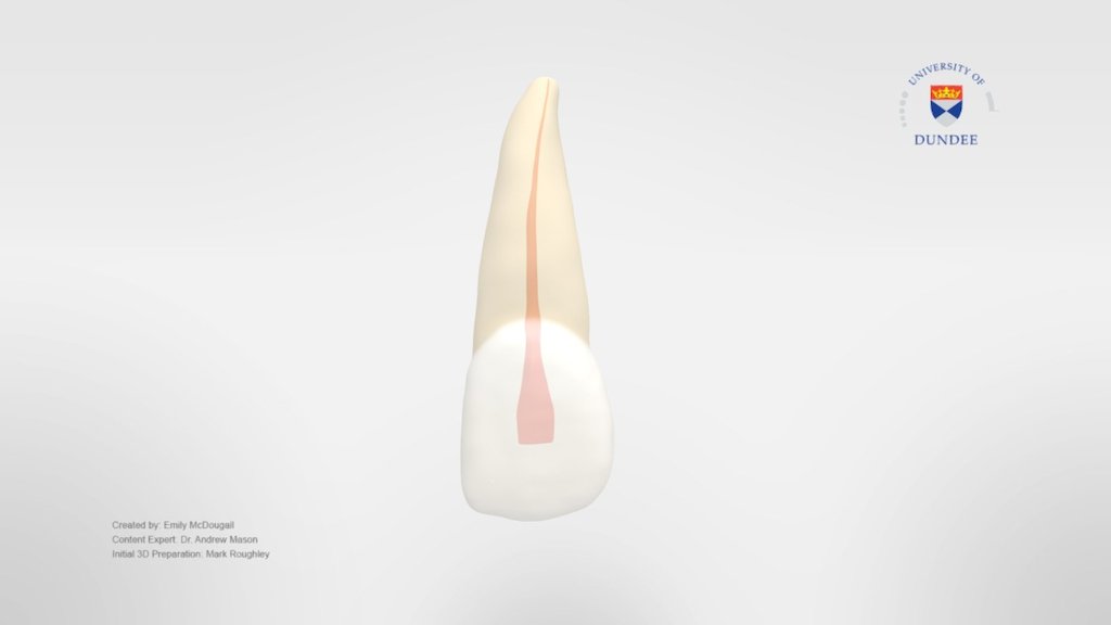 Maxillary Left Lateral Incisor: Endodontic - 3D model by University of ...