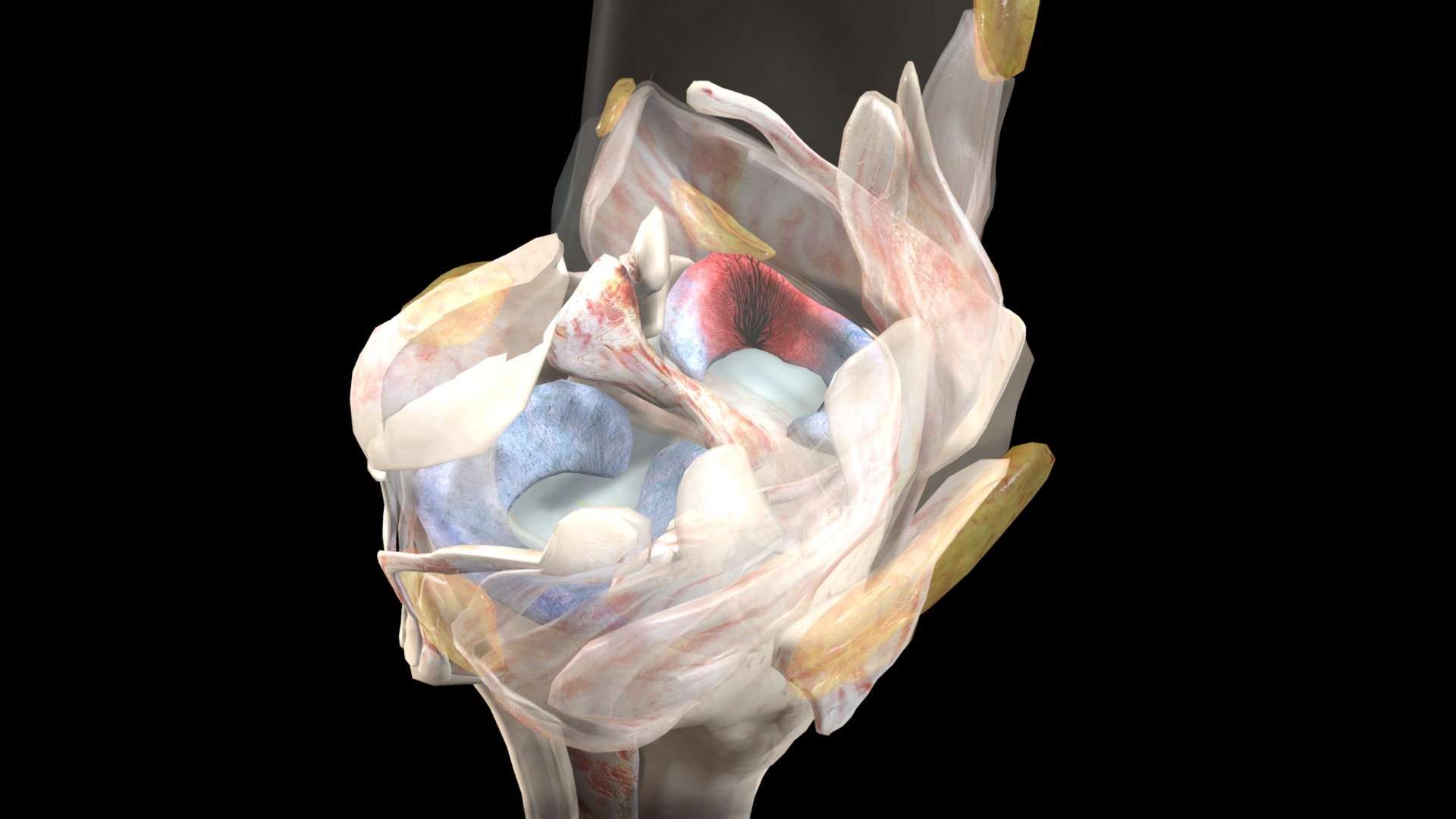 Medial meniscus radial tear - 3D model by 3D History (@IUI ...