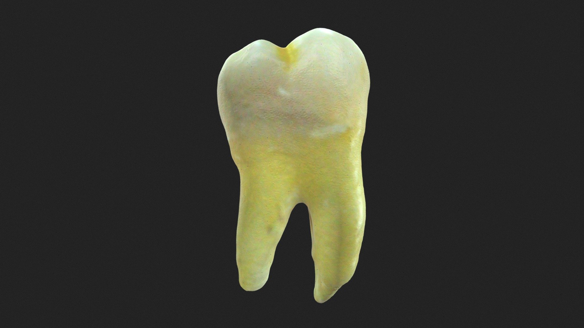 SEGUNDO MOLAR INFERIOR DERECHO PERMANENTE - Download Free 3D model by ...