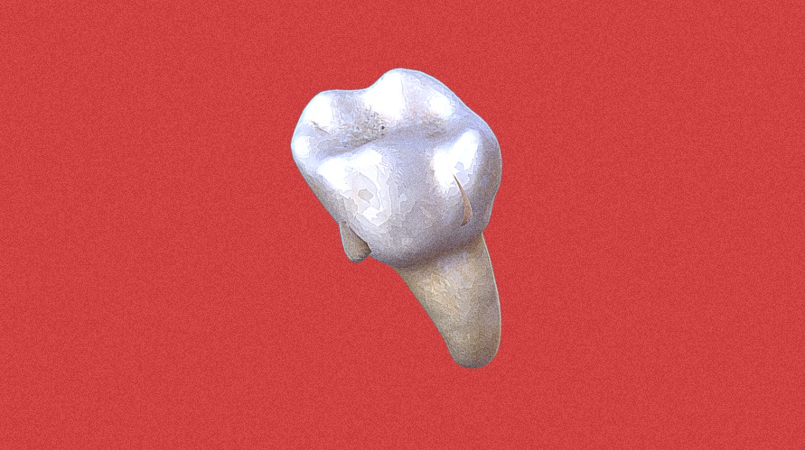 Tooth - 3D model by ichocomeli [48beea7] - Sketchfab