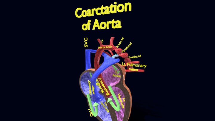 Aorta 3D models - Sketchfab