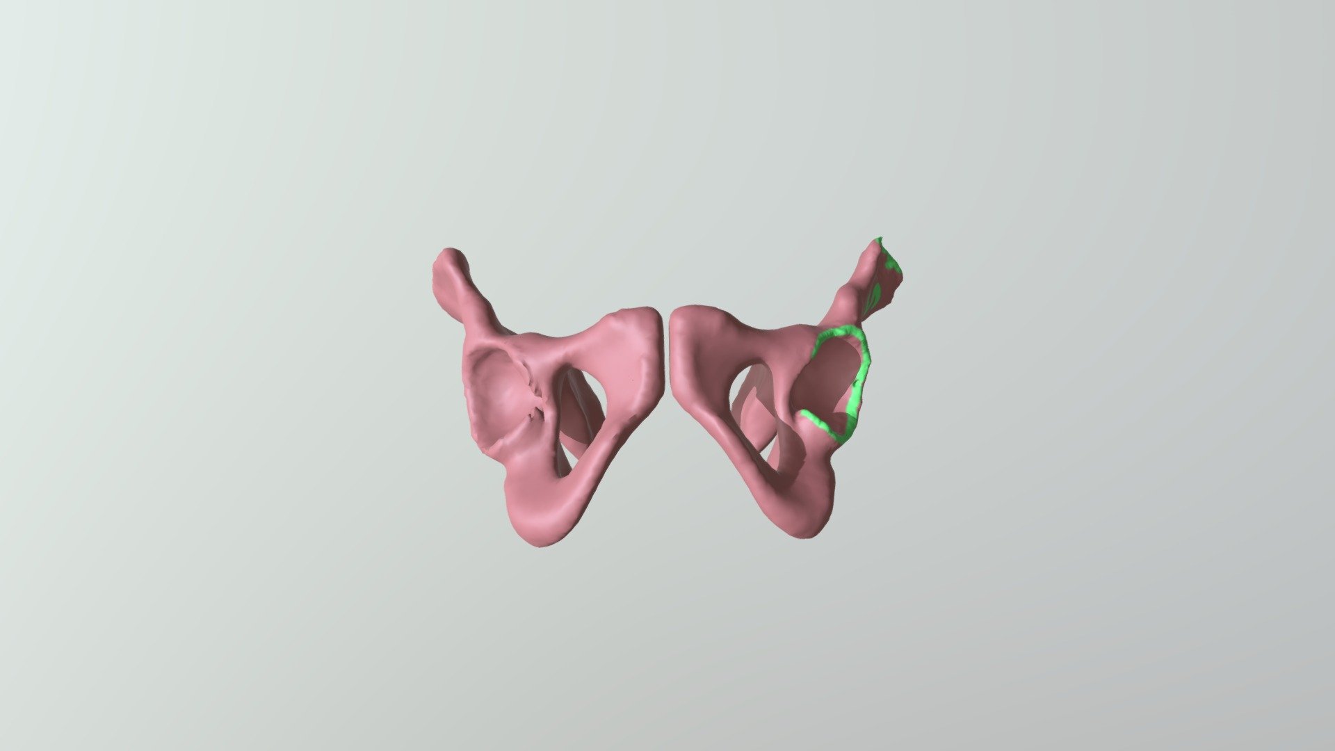 Pelvis Color - Download Free 3D model by lorenzo-guariento [4a7579b ...