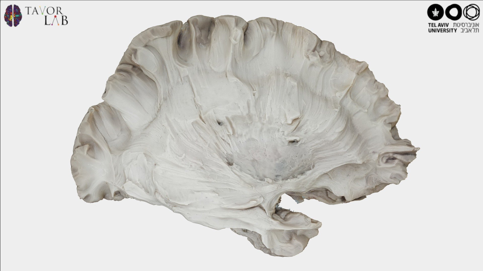 Lentiform nucleus and various fiber bundles - 3D model by TavorLab (@IT ...