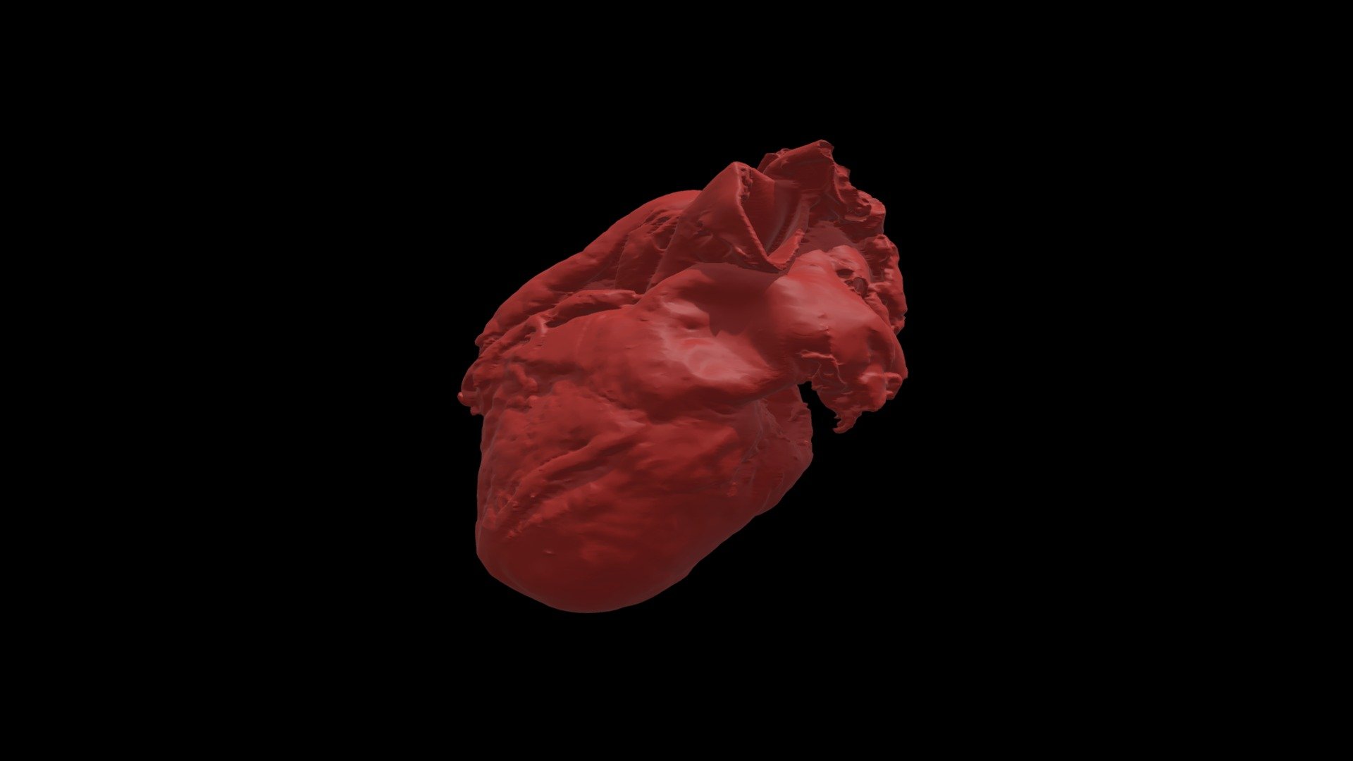 CC36951 Elderly Male with Removed Watchman - Download Free 3D model by ...