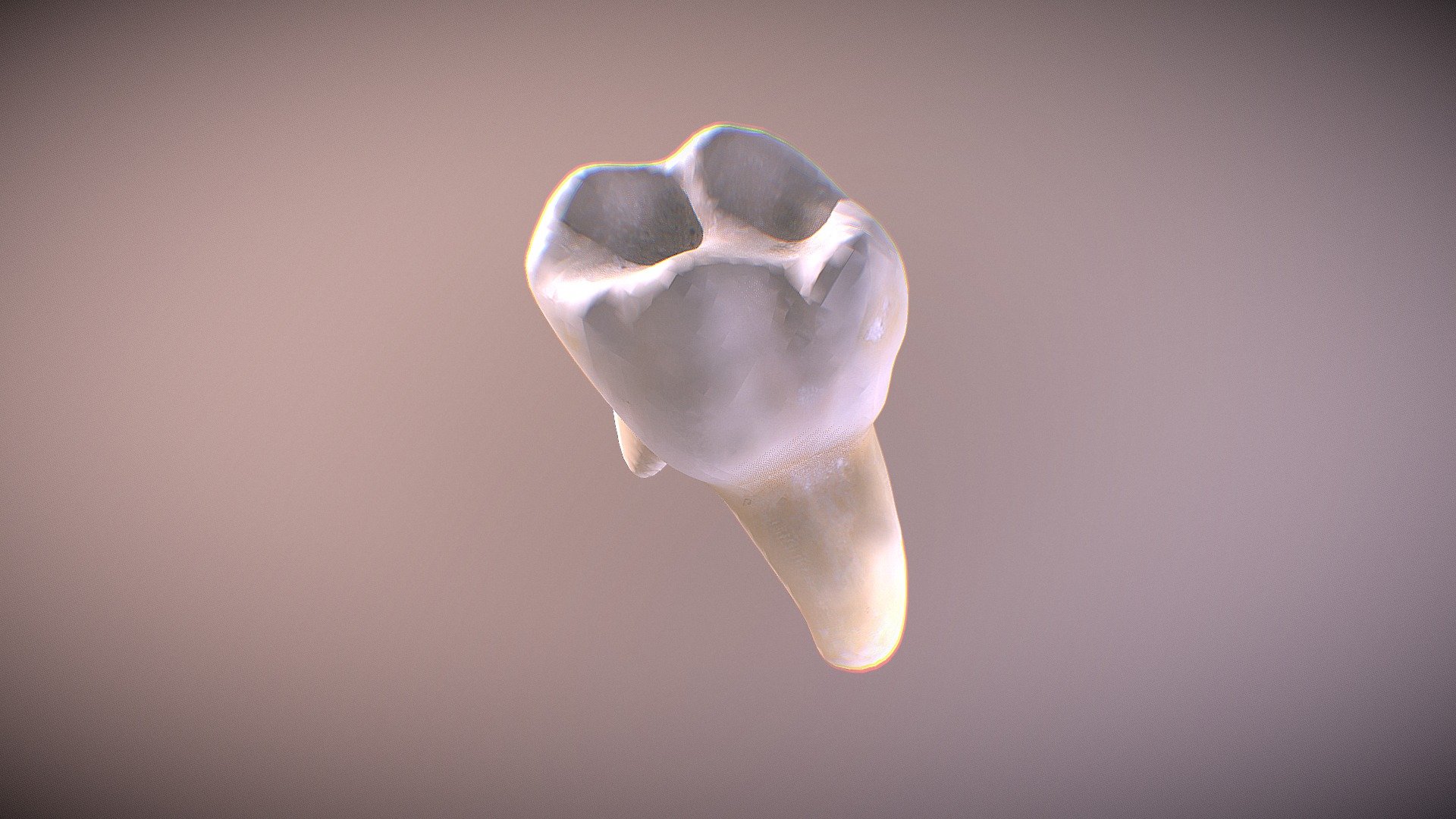 UD4 Tooth - 3D model by msoledad.aguilar.segura [4a9f1fe] - Sketchfab