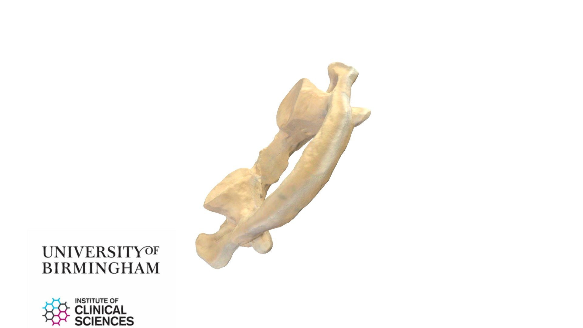 Atlas (C1 Vertebra) - 3D model by UoB_Anatomy (@UoB_Anatomy) [4aca76a ...
