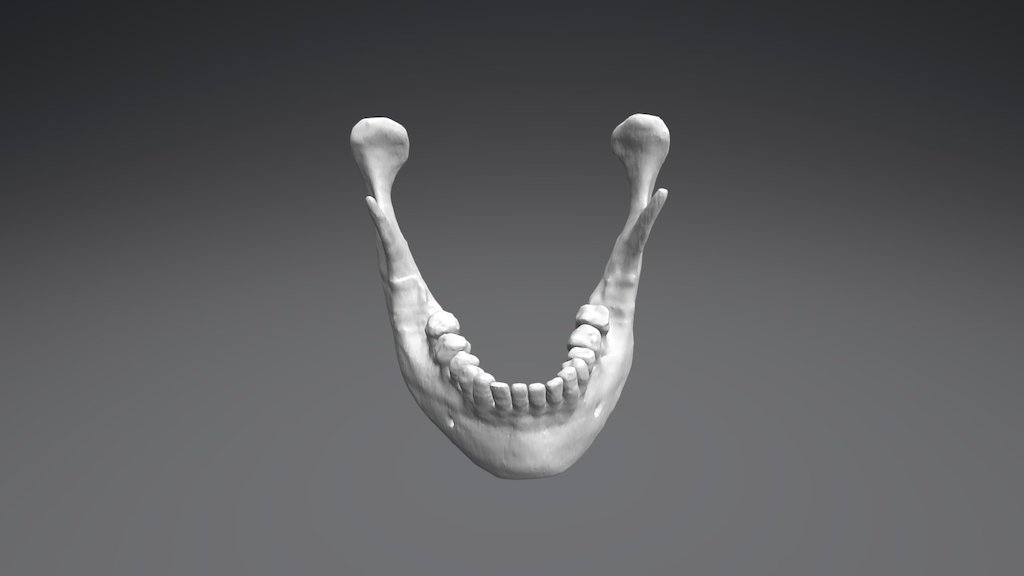 Jaw - 3D model by Clínica 3D (@clinica3d) [4b00b32] - Sketchfab