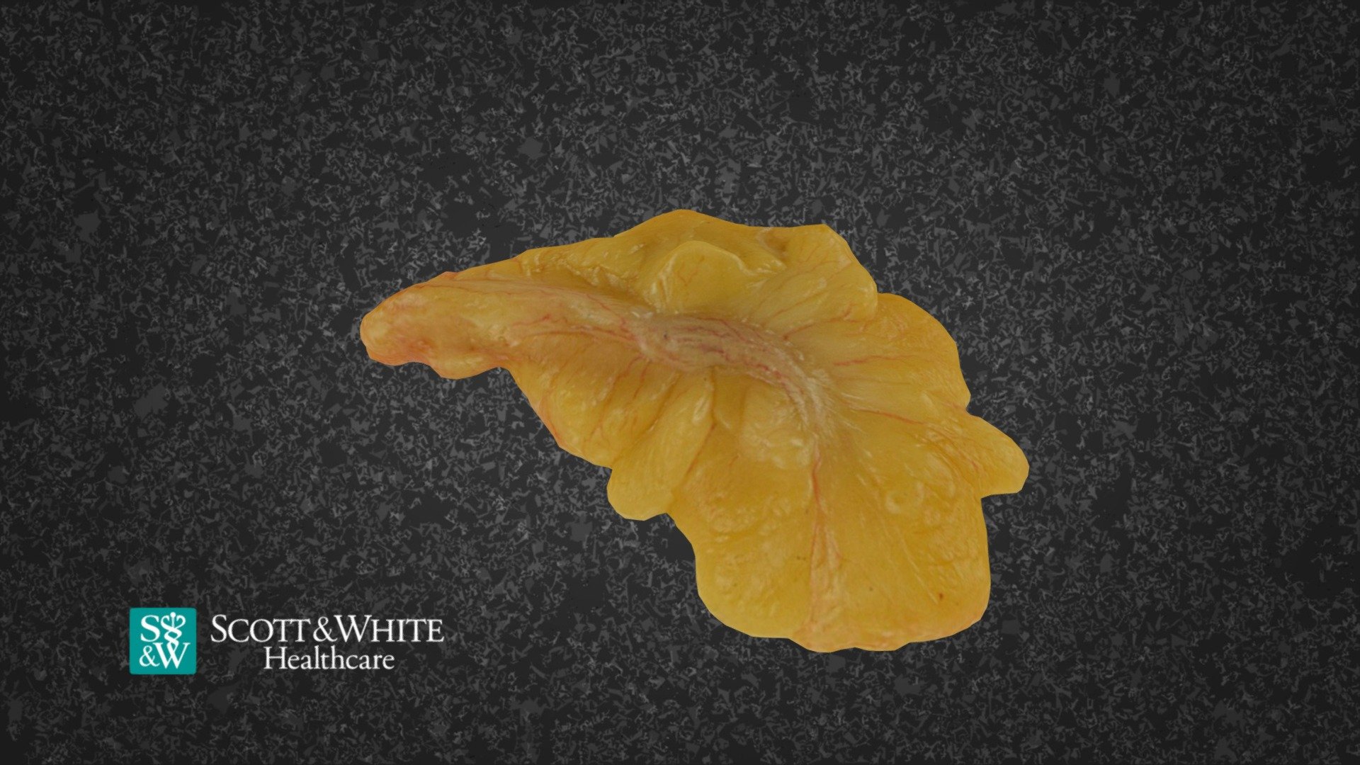 Appendix 65895 - 3D model by Scott & White Moulage Project (@swmoulage ...