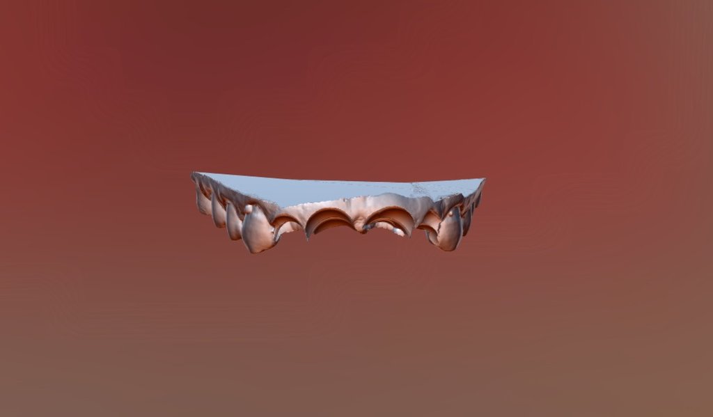 virtual extraction - 3D model by pandeswap [4b47ca3] - Sketchfab