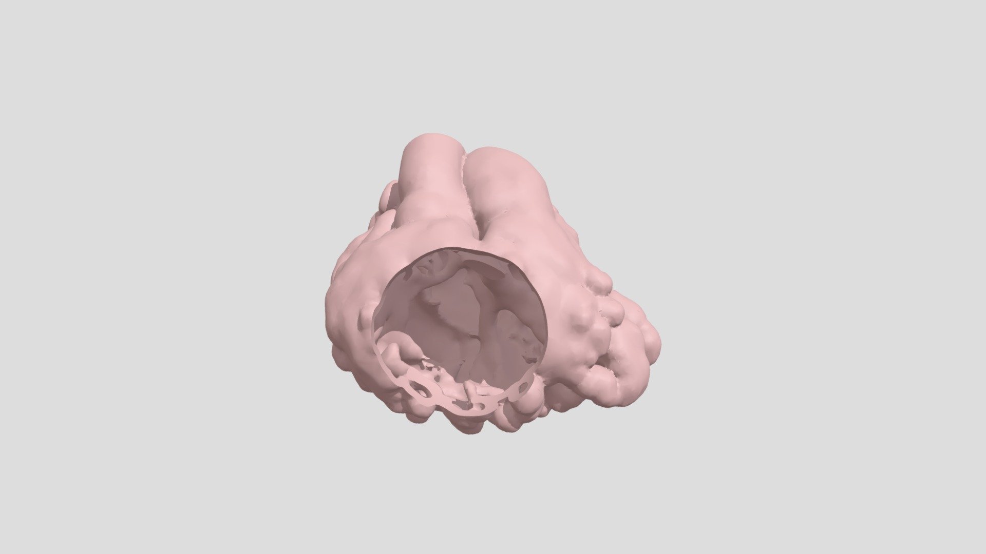 DORV, VSD, Malposed Great Arteries (H0368) - 3D model by NCHS Cardiac ...