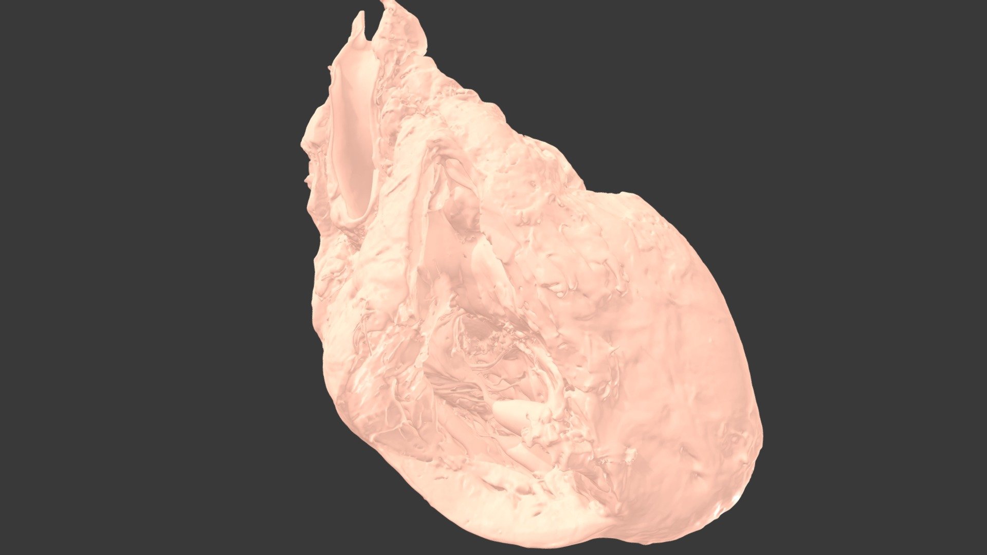 Vsd 8 {s D S} With Membranous Vsd 3d Model By Heartmodels [4c0946e