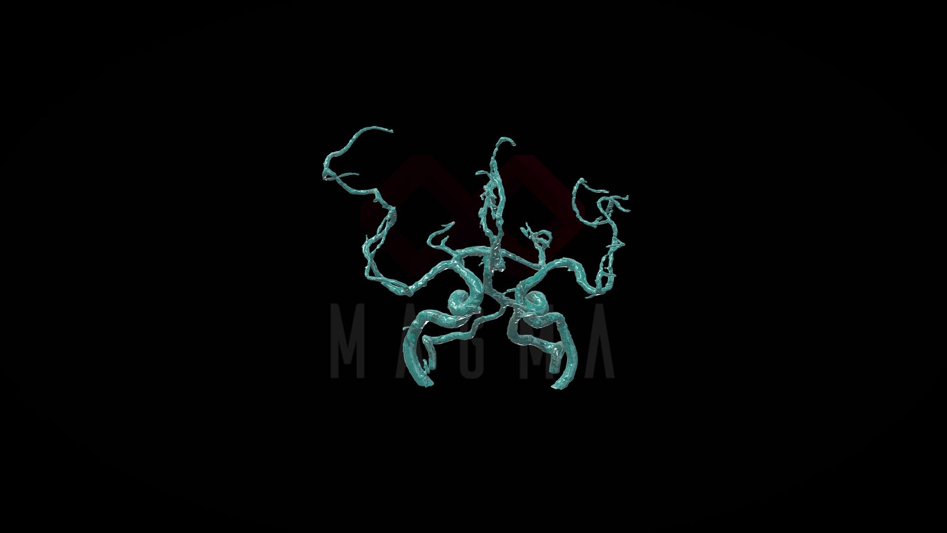 JFO41 - ACom Aneurysm - 3D model by Dr. Samuel Damin (@sdamin) [4c23e0f ...
