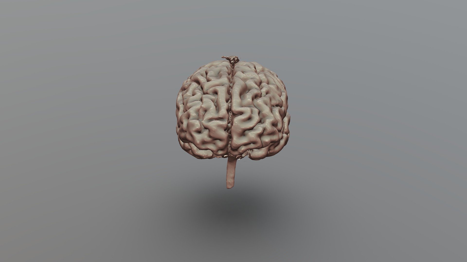 Segmentation_Brain - Download Free 3D model by alejandros [4c41124 ...