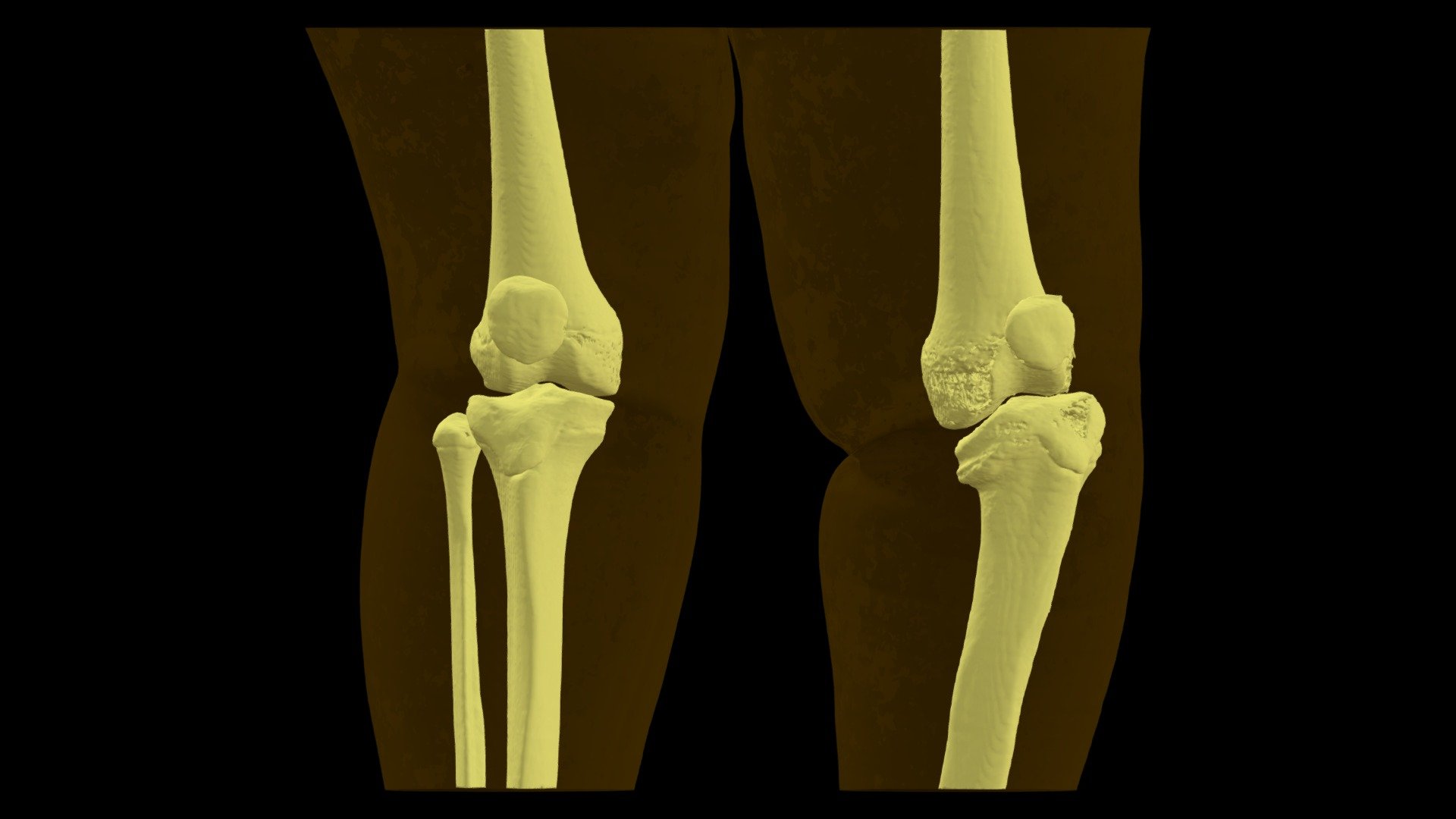 Rodilla - 3D model by quequen [4ce7ab3] - Sketchfab